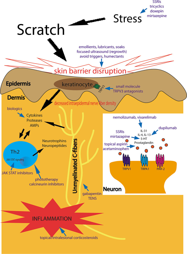 Neuropathic itch, Neurodermitis (follow up from rash post) stack help ...